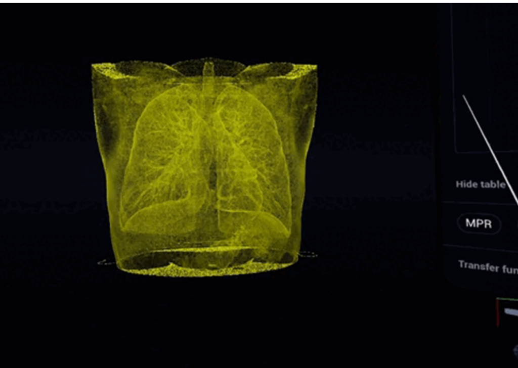 Digital Medical Imaging in VR - Bodyscope
